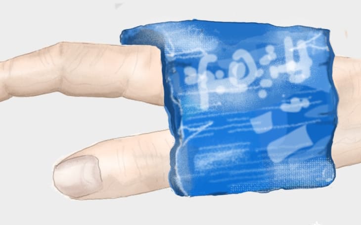 Fingerbruch - Behandlung & Prognose