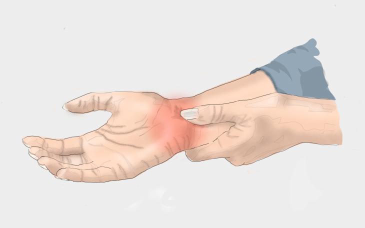 Polymyositis - Anzeichen, Behandlung & Prognose